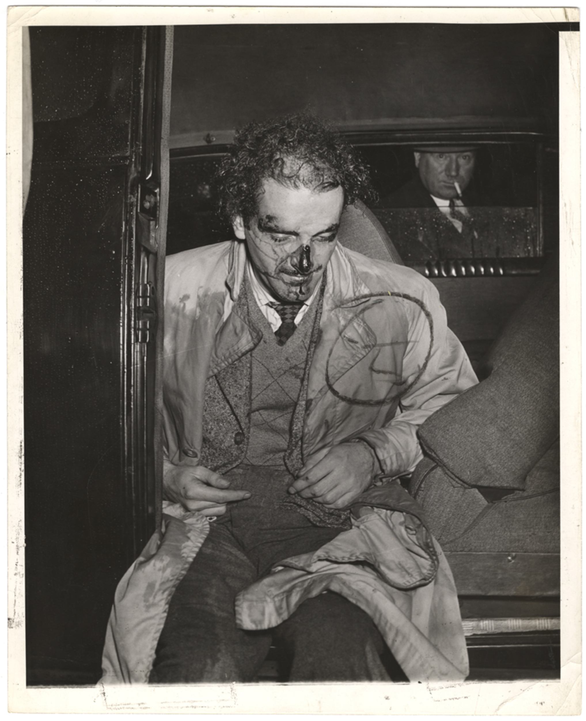 [Man with bloody face] | International Center of Photography