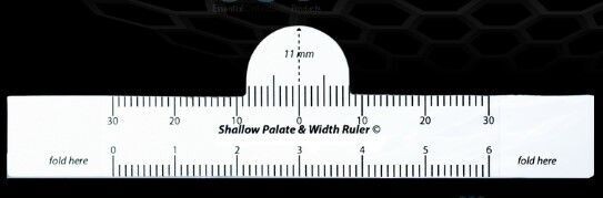 Arch Development Rulers 10/pkg