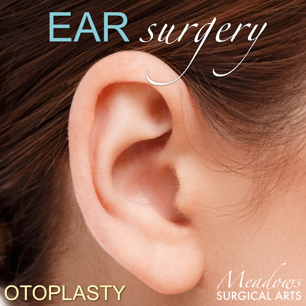 Ear Surgery (Otoplasty) | Pin back protruding ears!