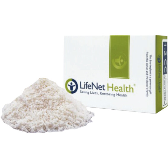 Oragraft® Cortical FDBA Particulate ( 250-1000 microns ) 0.7cc