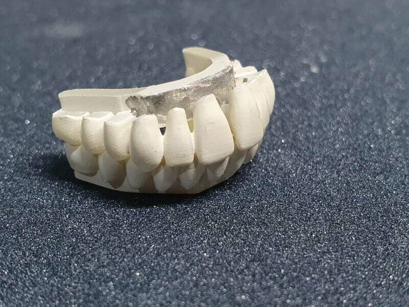 Terminator T800 1/2 Scale Replacement Teeth