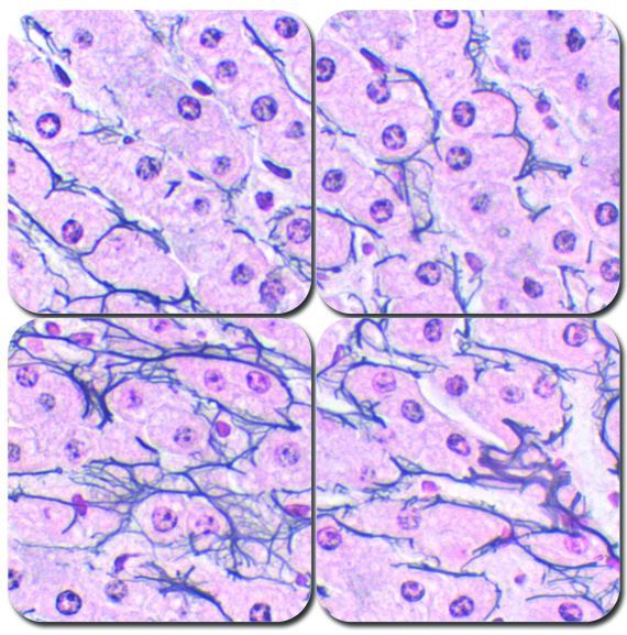 Reticulum Stain Kit, Chandler's Precision