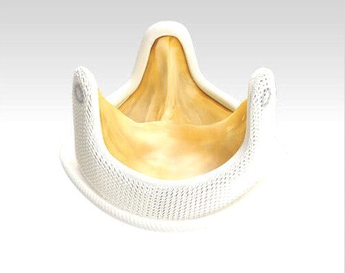 Hancock Bioprosthesis