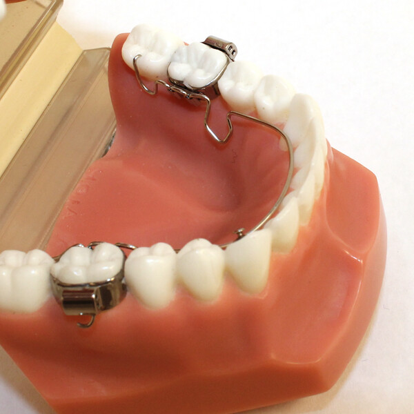 Arco lingual 3D ® – Productos – RMO MÉXICO