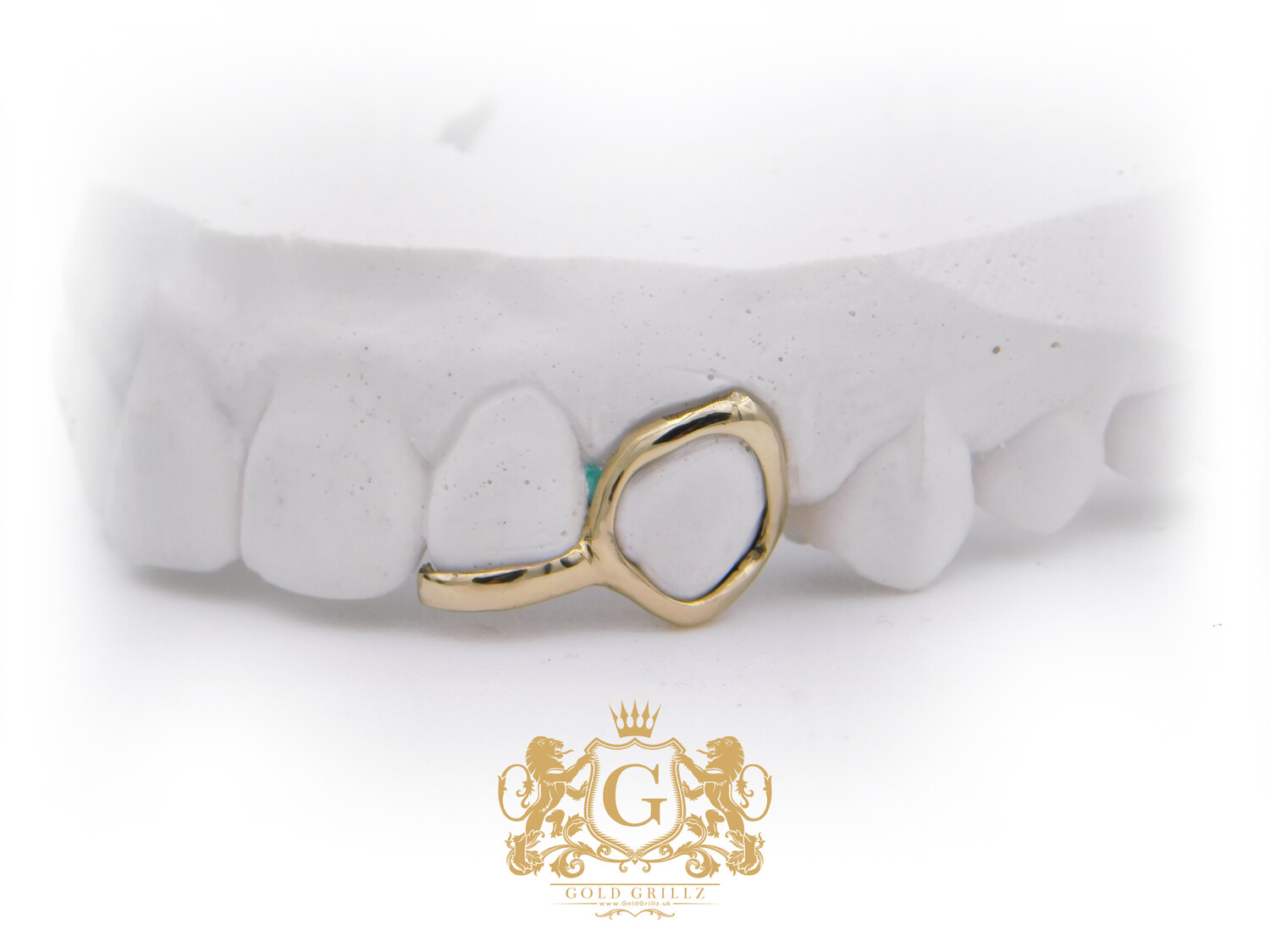 Gold Teeth Window Design & Gold strip - Buy Online or In Store