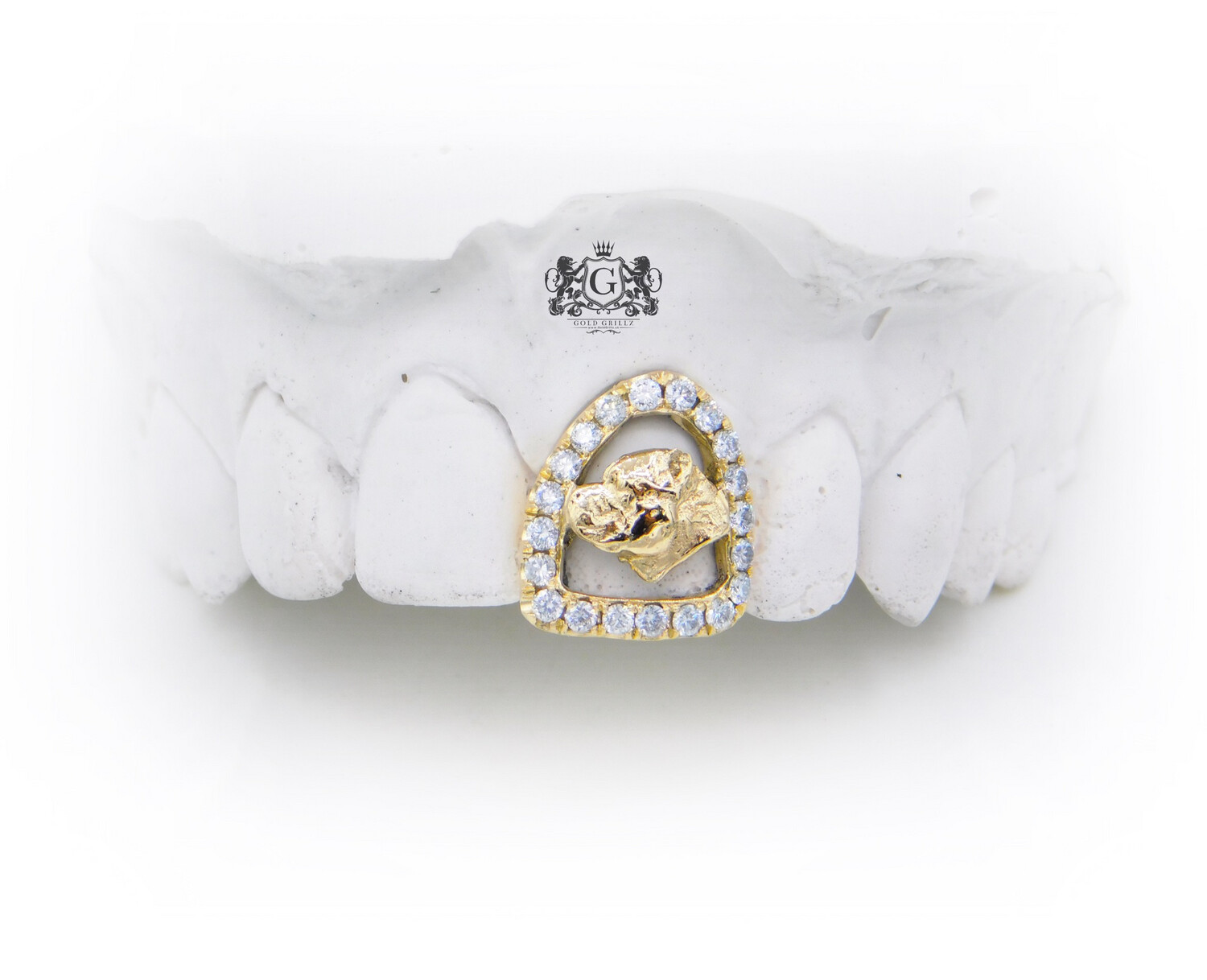 Diamond Bully - Single Gold Teeth With Diamonds