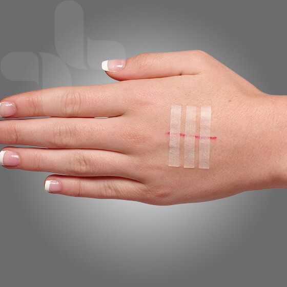 Wound Closure Strips 6mm x 75mm cards x 3 strips pre card