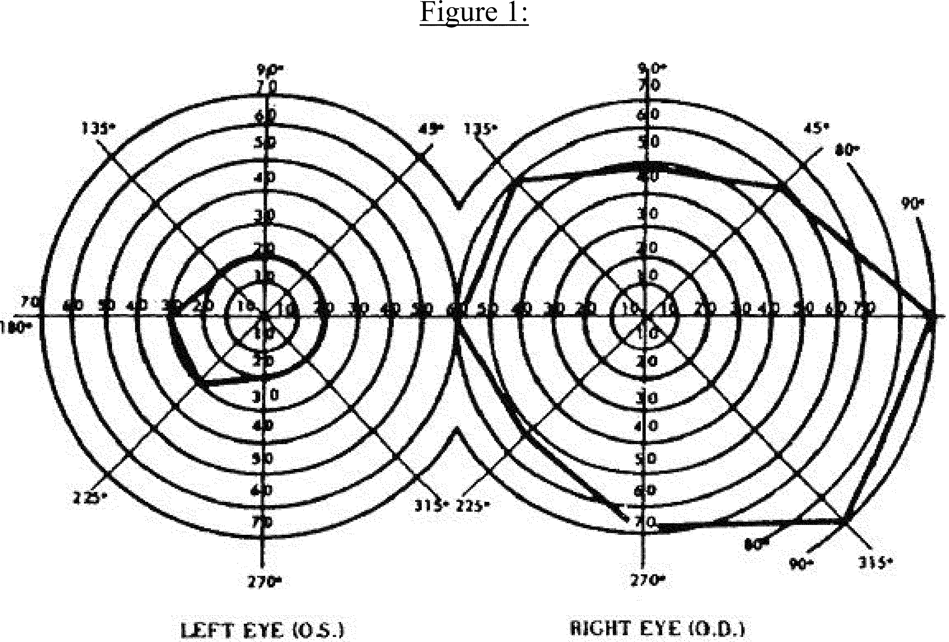 Federal Register | Revised Medical Criteria for Evaluating Visual Disorders