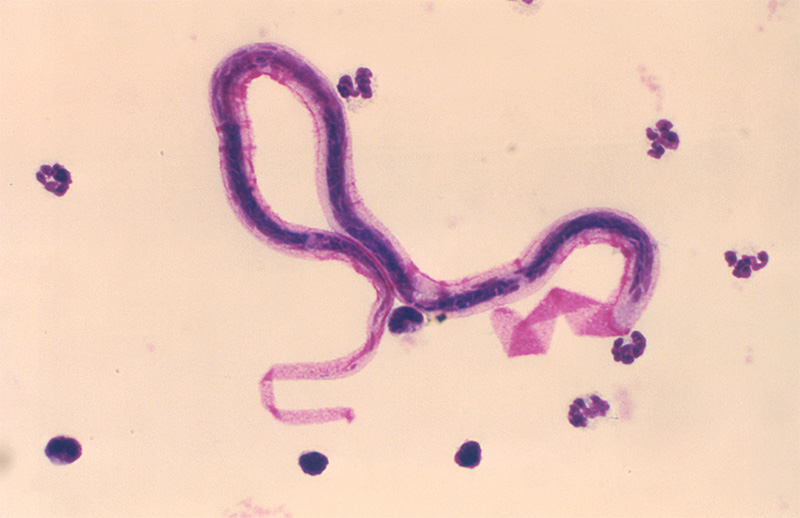 Parasites In Humans: Six Skin-Crawling Creatures to Avoid