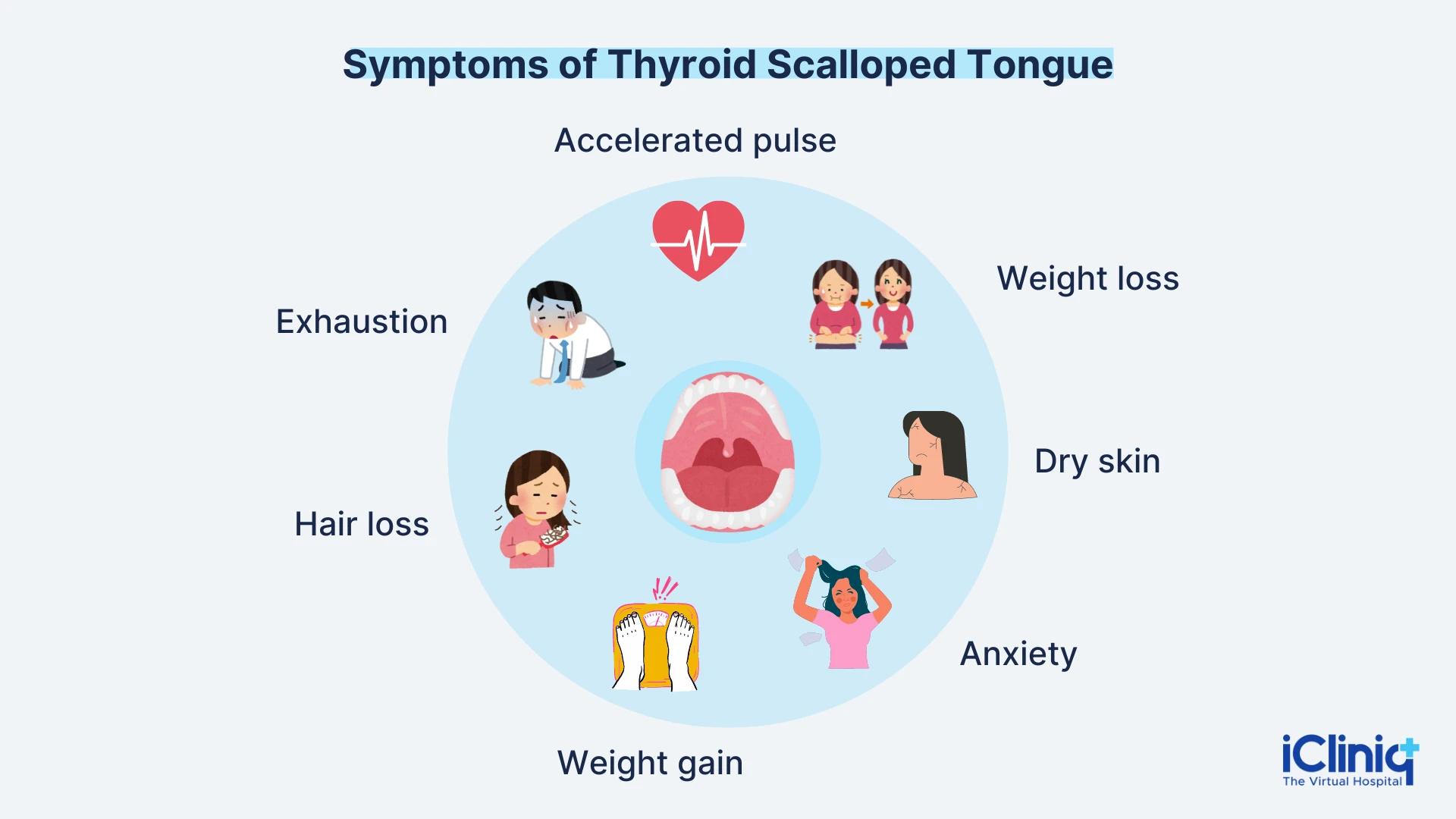 What Is Thyroid Scalloped Tongue?