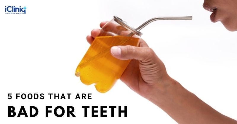 5 Foods That Are Bad for Teeth - Health Tips | iCliniq