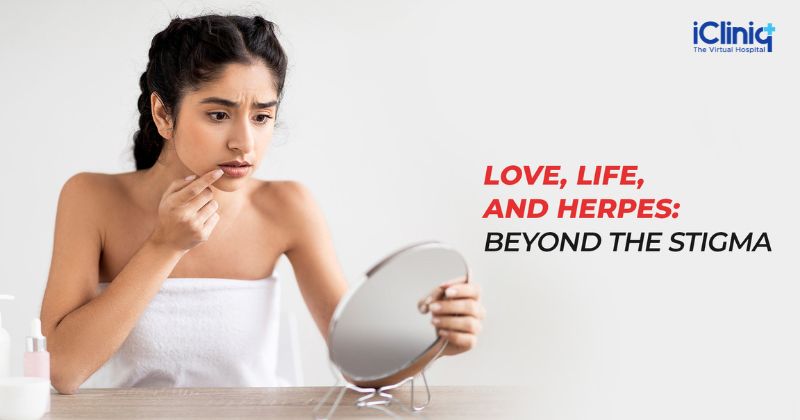 Love, Life, and Herpes: Beyond the Stigma - Health Tips | iCliniq