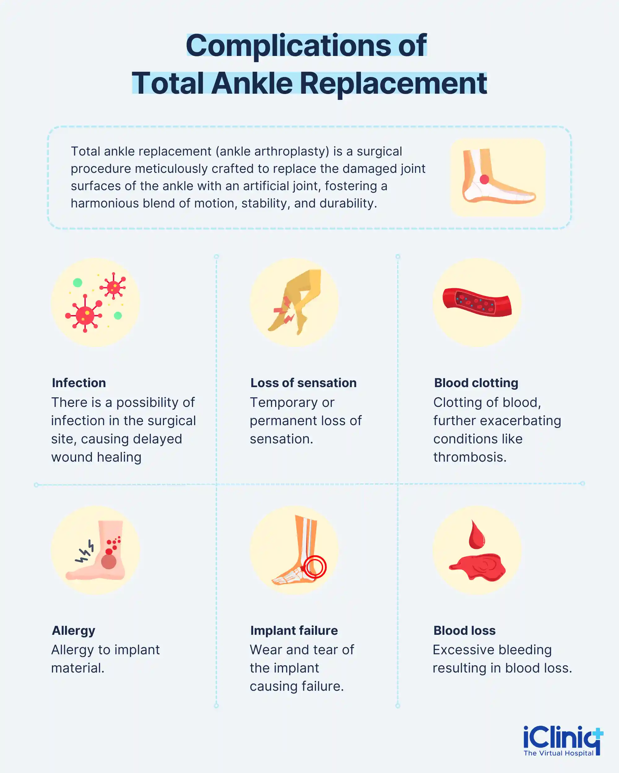 What Is Total Ankle Replacement?