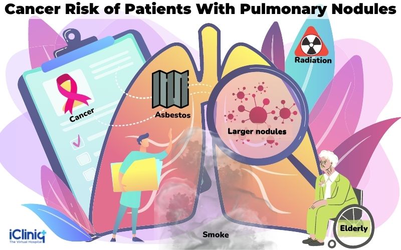 Lung or Pulmonary Nodule | Causes | Symptoms | Diagnosis | Treatment