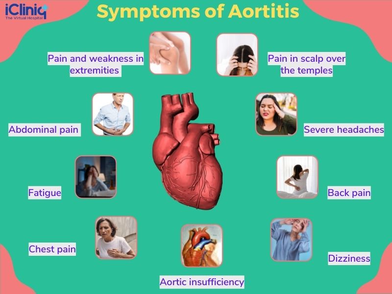 Aortitis - Symptoms | Causes | Diagnosis | Treatment