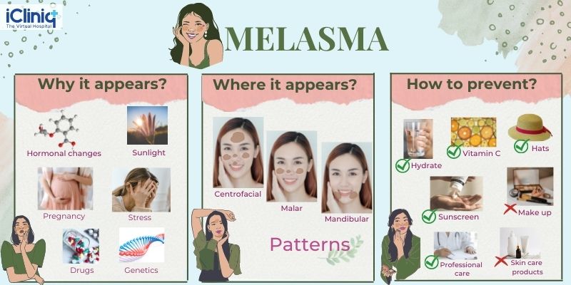 Melasma (Dark Patches on Face): How to Get Rid of Them