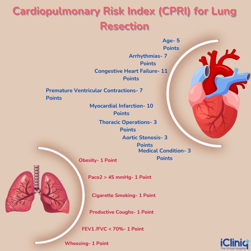 What Is Thoracic Anesthesia?