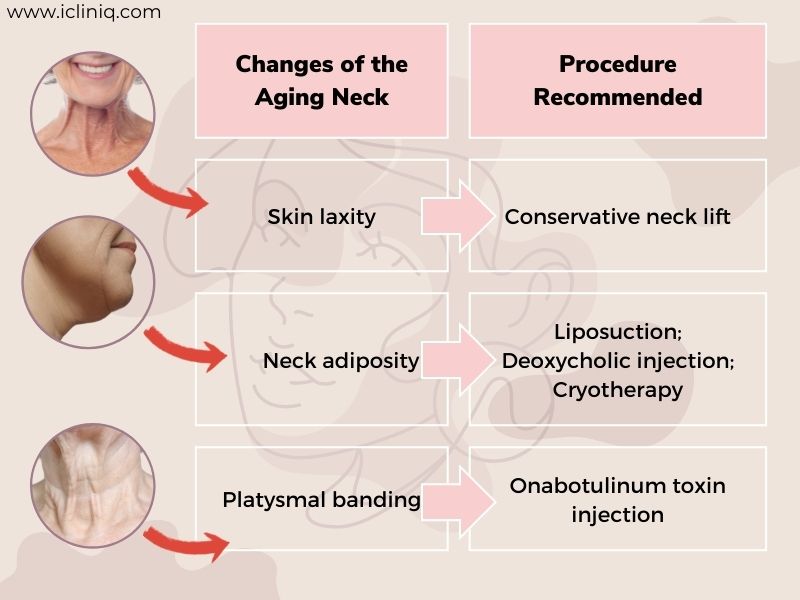 What Is Neck Rejuvenation?