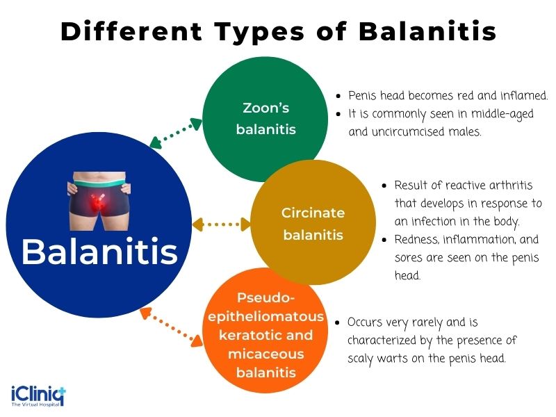 What Is Balanitis Circumscripta Plasmacellularis What Is Balanitis Circumscripta Plasmacellularis
