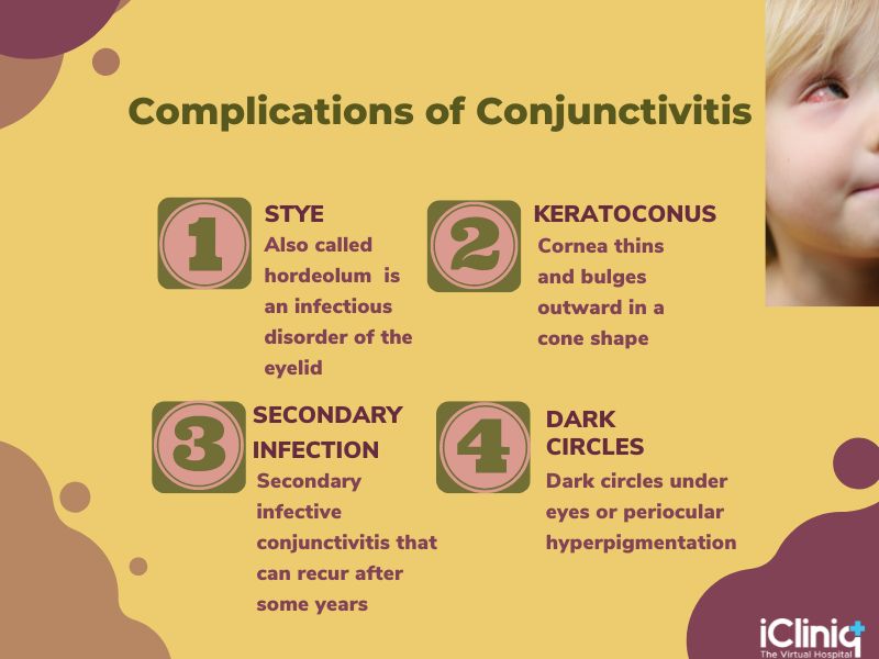 Allergic Conjunctivitis Treatment