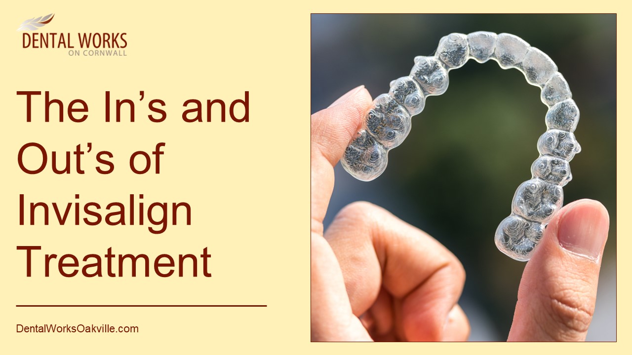 PPT – The Ins and Outs of Invisalign Treatment PowerPoint presentation ...