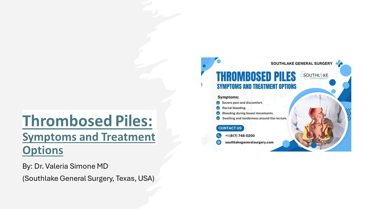 Thrombosed Piles: Symptoms and Treatment Options presentation | free to download
