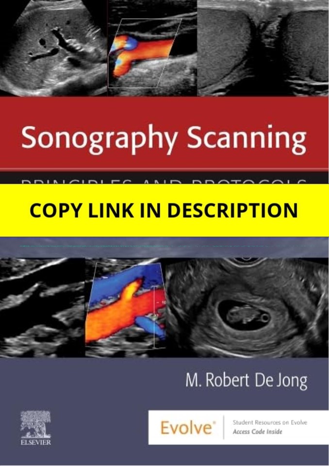 PPT – Download Sonography Scanning: Principles and Protocols 5th ...