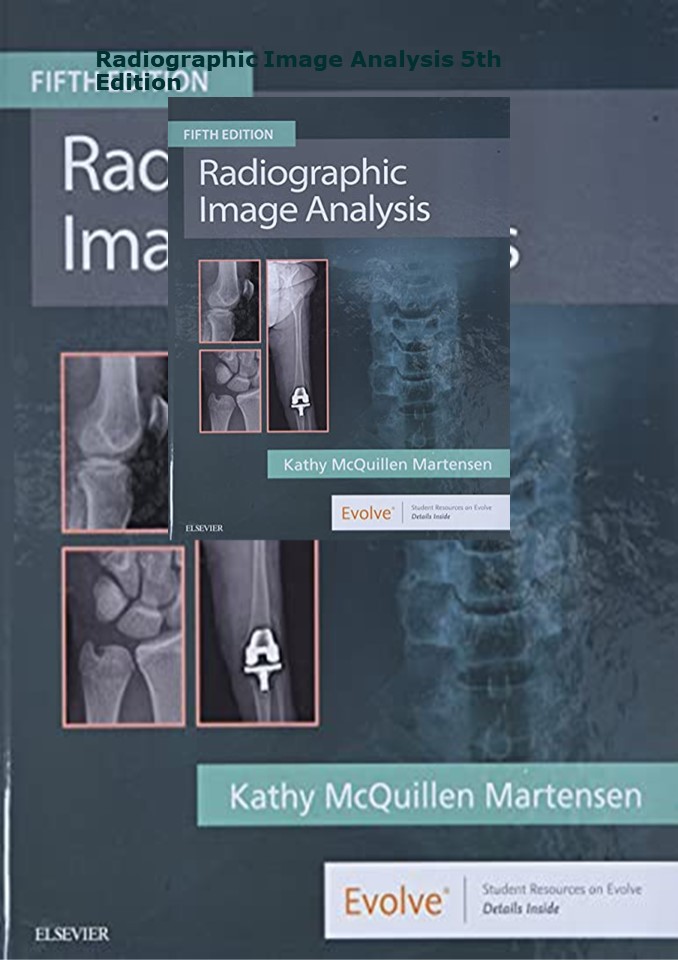 Pdf⚡️(read ️) Radiographic Image Analysis 5th Edition presentation ...