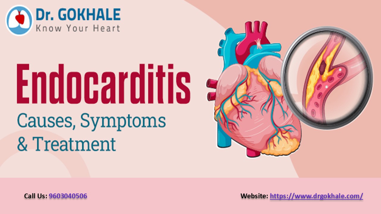 Endocarditis: Causes, Symptoms and Treatment | Dr Gokhale presentation ...