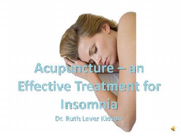 PPT – Acupuncture - an Effective Treatment for Insomnia PowerPoint ...