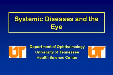 Systemic Diseases and the Eye Department of Ophthalmology presentation ...