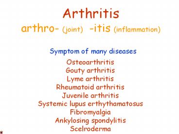 Arthritis presentation | free to download
