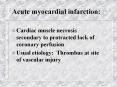 PPT – Acute Myocardial Infarction PowerPoint presentation | free to ...