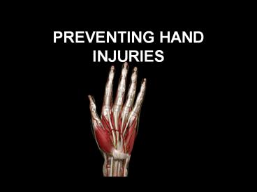 PREVENTING HAND INJURIES presentation | free to download