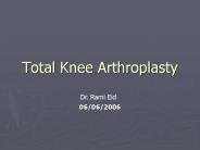 PPT – TOTAL KNEE ARTHROPLASTY PowerPoint presentation | free to view ...