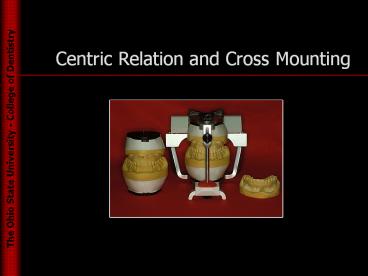 Centric Relation and Cross Mounting Facebow Transfer Centric ...