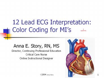 12 Lead ECG Interpretation: Color Coding for MI’s presentation | free to view
