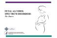 PPT – Fetal Alcohol Spectrum Disorders FASD: Diagnosis, Effects ...
