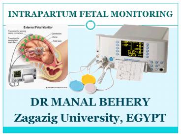 Intrapartum fetal monitoring for undergraduate presentation | free to ...