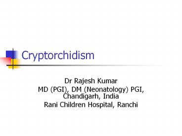 Cryptorchidism presentation | free to view