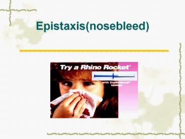 Epistaxis(nosebleed) presentation | free to view