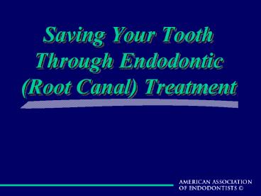 PPT – Saving Your Tooth Through Endodontic (Root Canal) Treatment ...