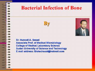 PPT – Bacterial Infection of Bone PowerPoint presentation | free to ...