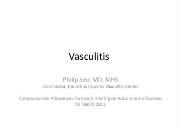 Vasculitis presentation | free to download
