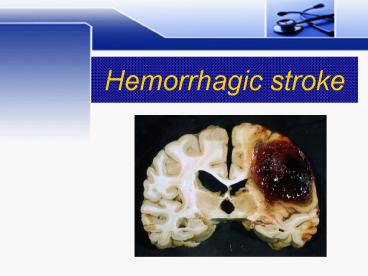 Hemorrhagic stroke presentation | free to view