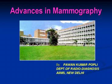 PPT – Advances in Mammography PowerPoint presentation | free to view ...