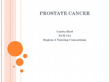 PPT – PROSTATE CANCER PowerPoint presentation | free to view - id: 41e2d4-ZWZkM