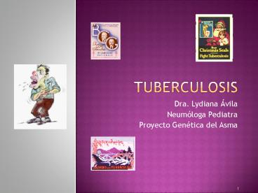 Tuberculosis presentation | free to view