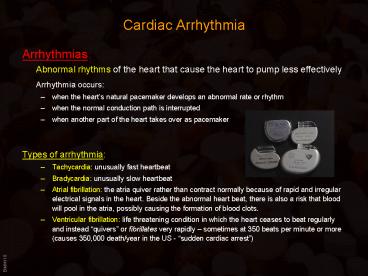 Cardiac Arrhythmia presentation | free to view
