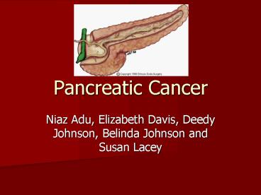 PPT – Pancreatic Cancer PowerPoint presentation | free to view - id ...